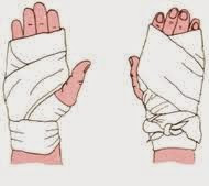 PROCEDIMIENTOS BASICOS: Tipos de vueltas en los vendajes