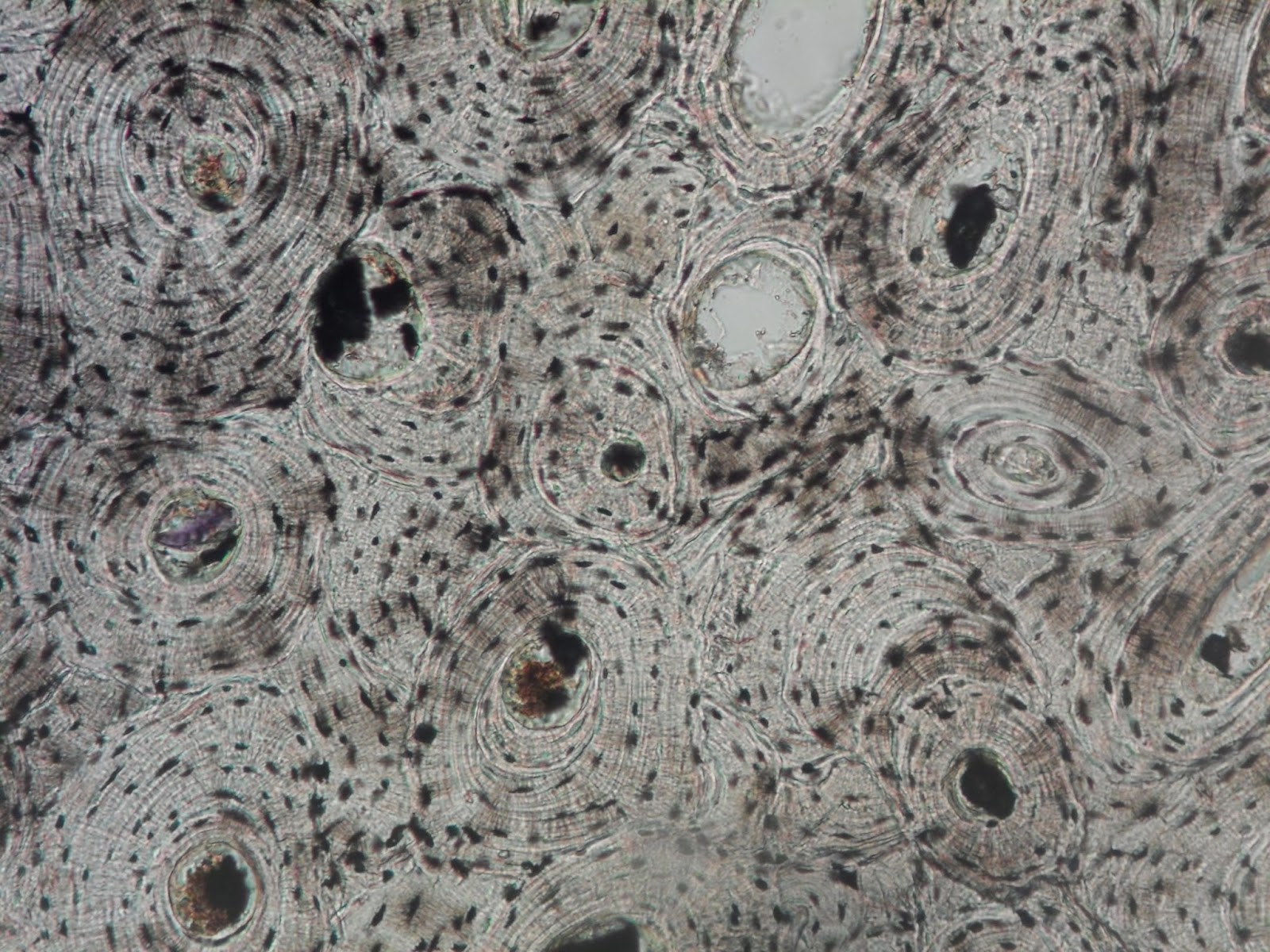 Ourlad's Paradigm: Connective Tissue