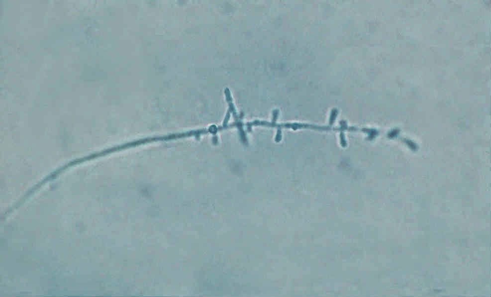 ATLAS MICOLOGIA: TRICHOPHYTON TONSURANS (2)