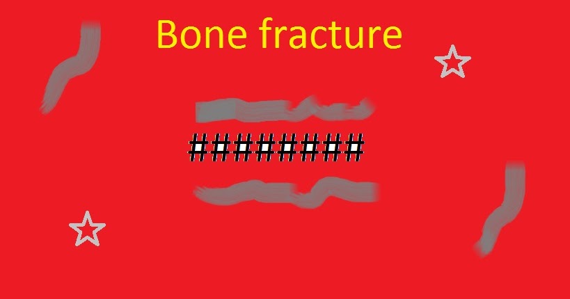 classification of the bone fracture