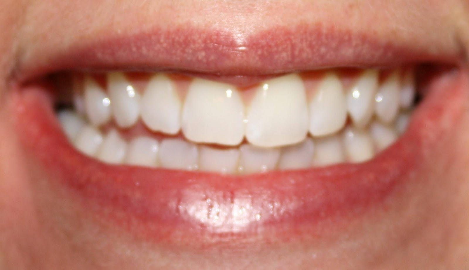 How to brush your teeth: How to Brush Your Teeth- Step By Step Instructions