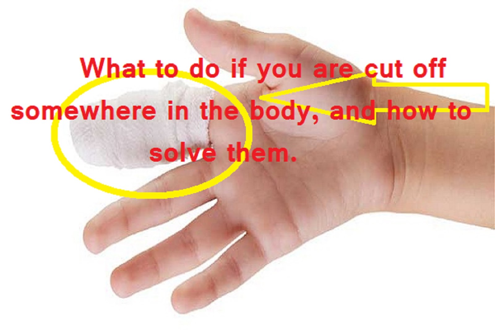 What to do if you are cut off somewhere in the body, and how to solve ...