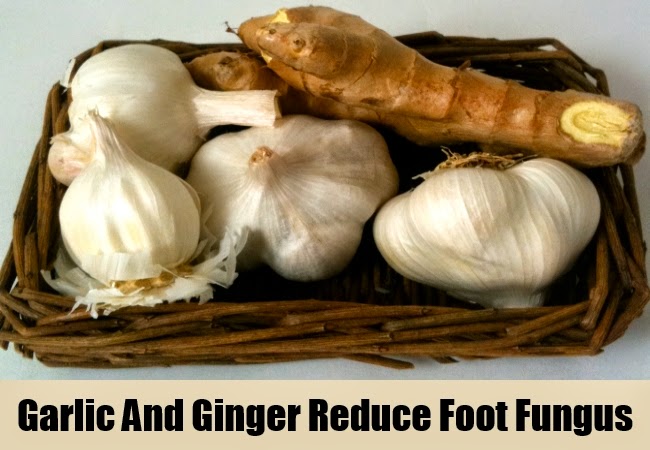TOP 5 HERBAL REMEDIES FOR FOOT FUNGUS ~ Mzizi Mkavu