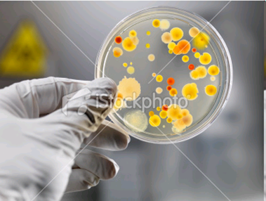 CULTURE MEDIA AND ITS TYPES | Careers-Biotech