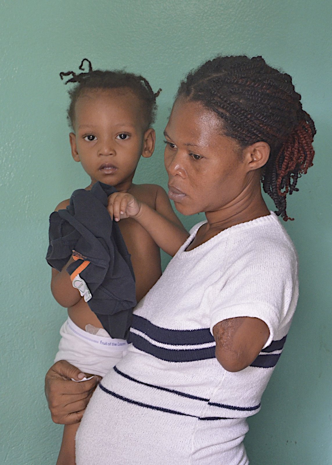 Dying in Haiti: Lost an Arm, Saved Two Lives