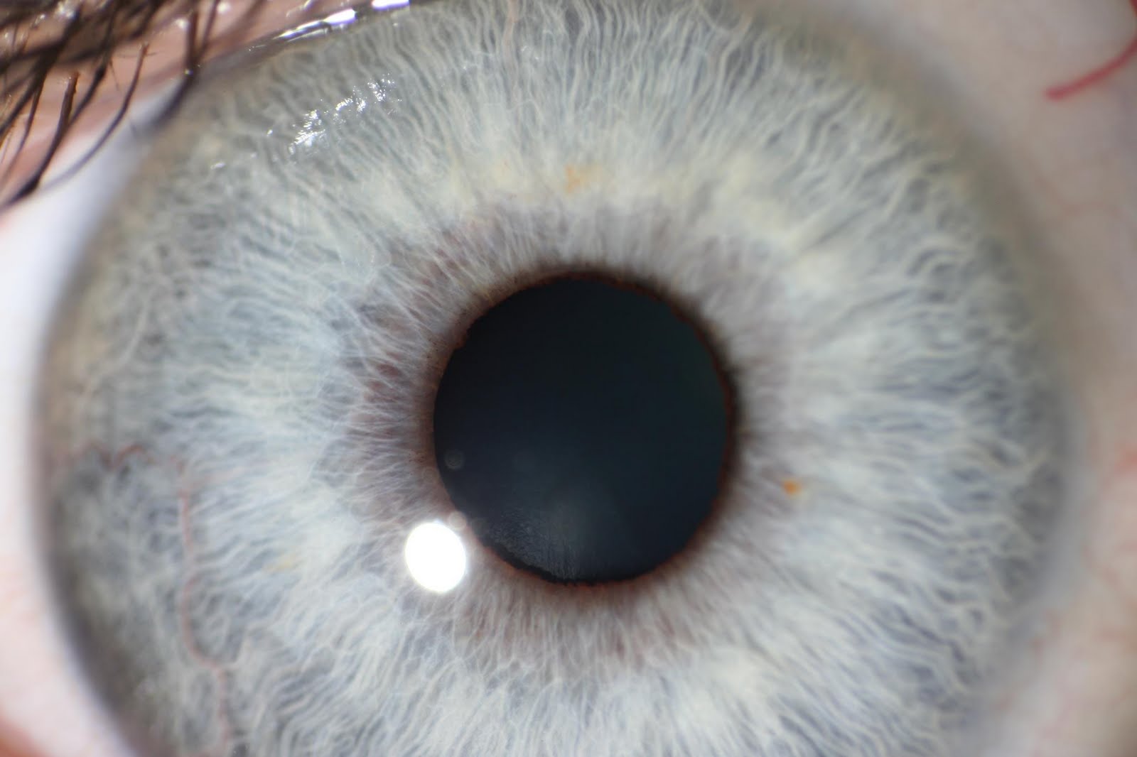 Modern & Multidimensional Iridology: Vascularized Transversal ...