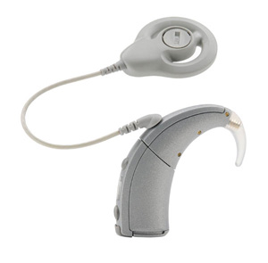 Revista Digital El Recreo: El implante coclear