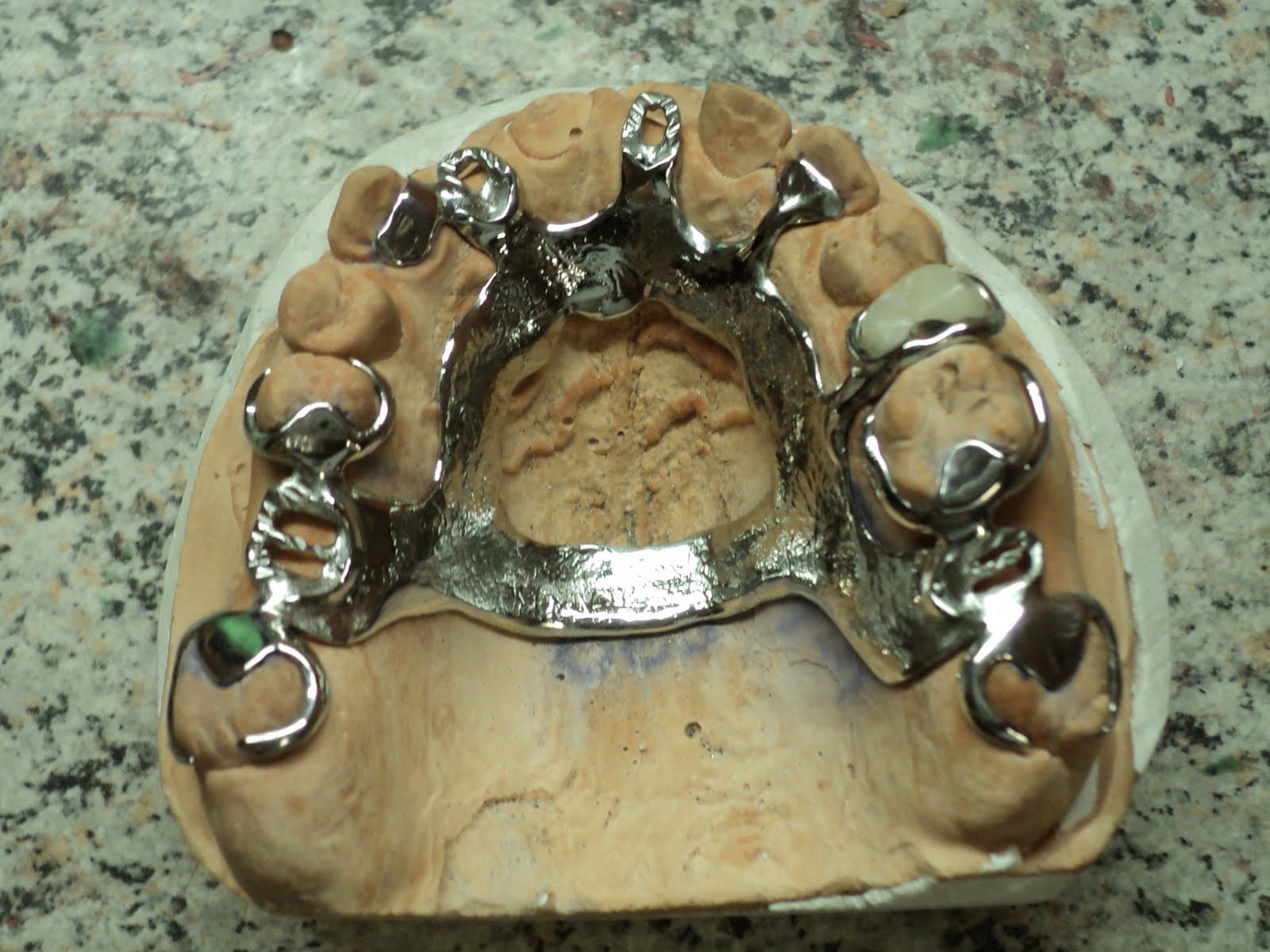 ESTRUTURAS METÁLICAS REMOVÍVEIS