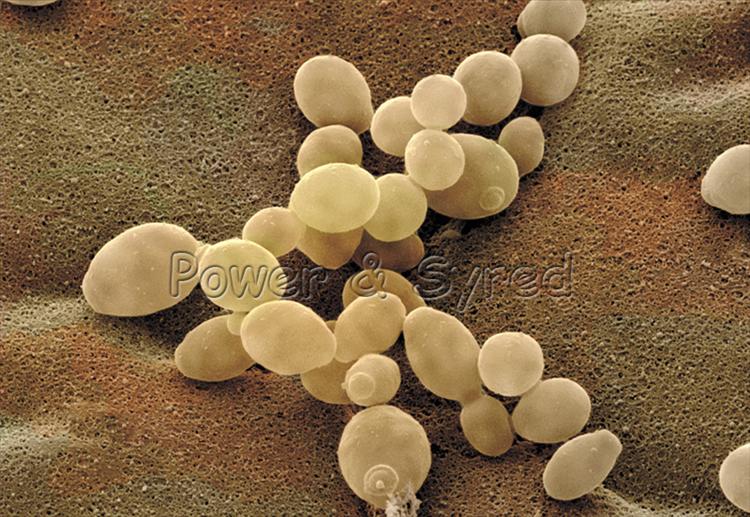 VETERINER: contoh dan jenis gambar mikroba beserta ciri-cirinya