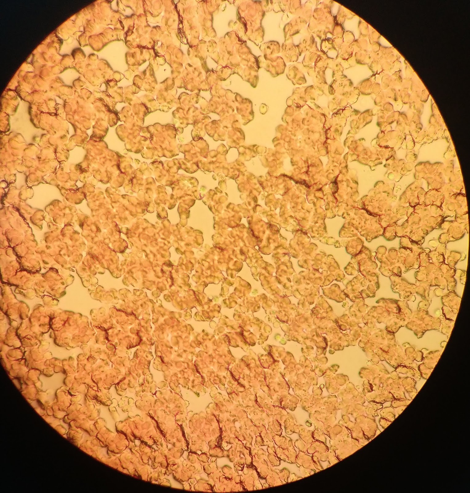 Práctica 7: Examen en fresco de sangre al microscopio.