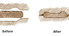 Mechanical Technology: Cold-Working Processes - Coining