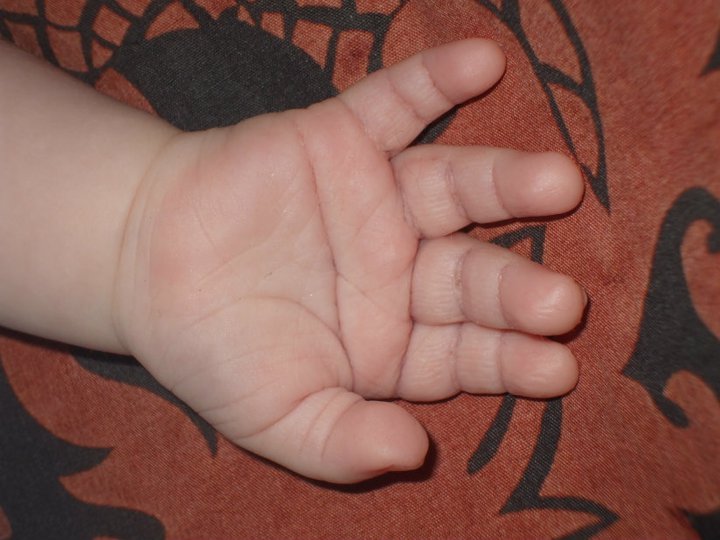 A Beautiful Life: So, what is Down Syndrome?