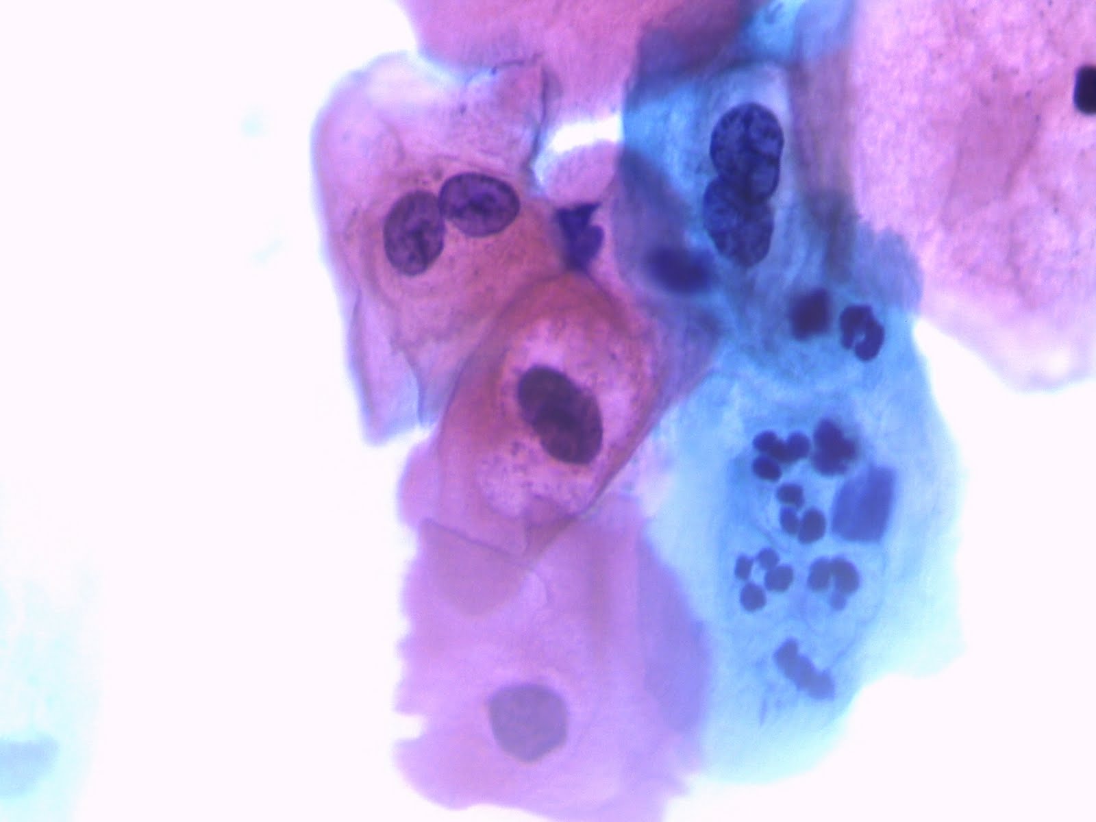 CIAP: ¿Qué es el Papanicolaou?