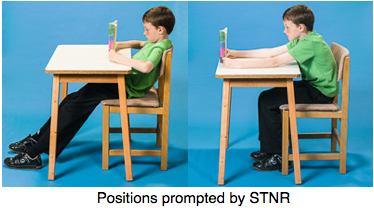 Whole-Brain Living and Learning: Understanding Symmetrical Tonic Neck ...