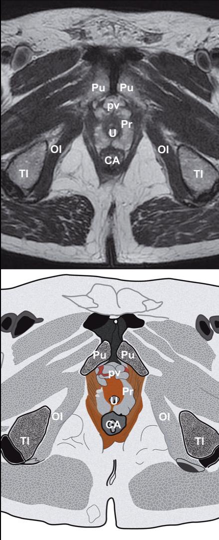 L’approche radio-anatomique de la région périnéale profonde et du ...