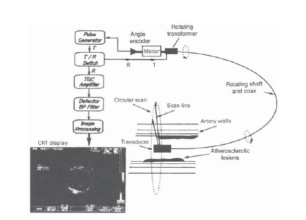A "MEDIA TO GET" ALL DATAS IN ELECTRICAL SCIENCE...!!: Mechanical Imaging Transducers