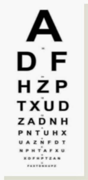 All Things Eye Por Yong Ming Understanding Your Spectacle Prescription All Things Eye Por Yong Ming Understanding Your Spectacle Prescription