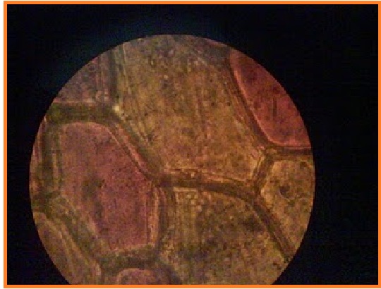 BIOLOGI GONZAGA: OSMOSIS - KRENASI - PLASMOLISIS