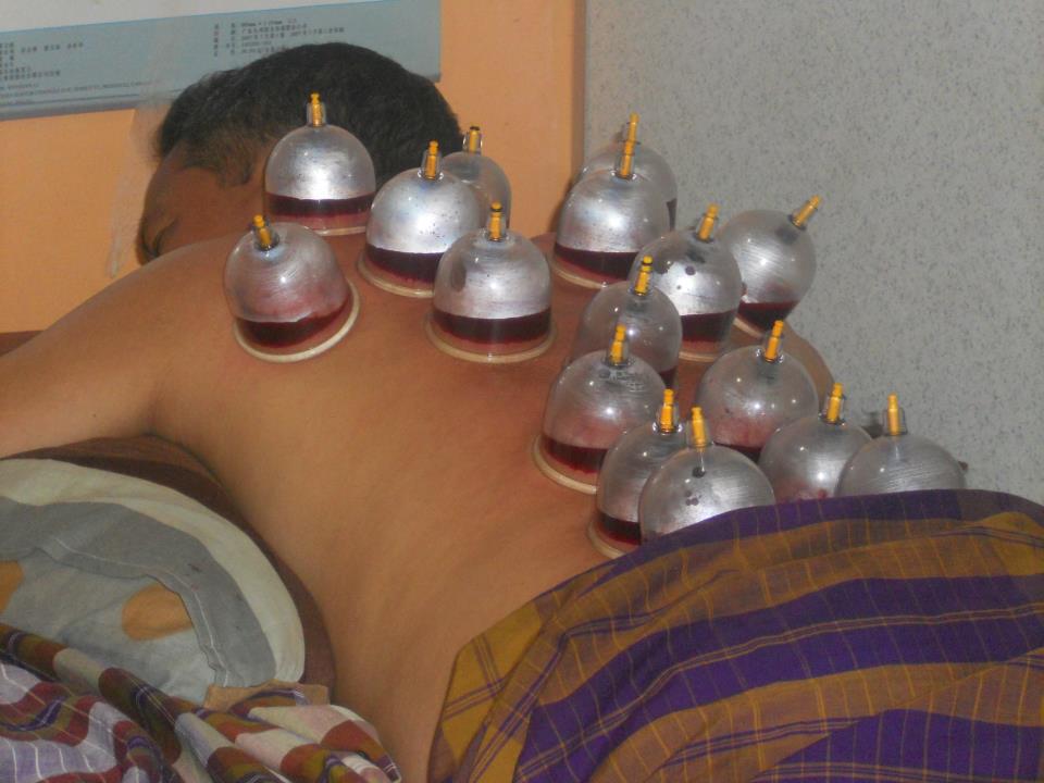 Bekam Reflex Spa: Pakej Urutan dan bekam