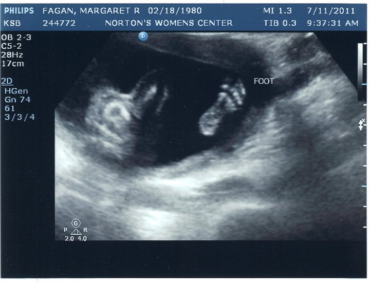 Baby Fagan 2011: 07/11/2011-5 Month Sonogram :)