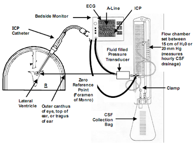 Intracranial Pressure (ICP).ppt | Free Medical Slids