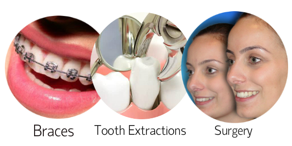 Which One To Choose among Invisalign, Braces and Surgery to Fix ...