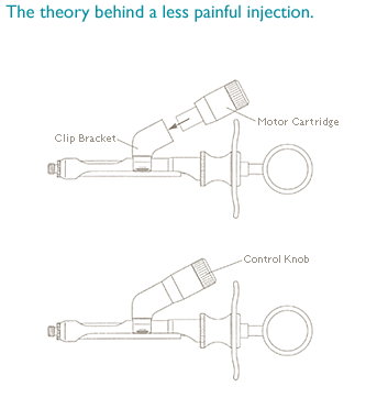 My Dental Abode: Vibraject : The analgesic syringe clip