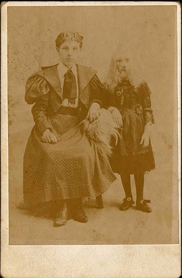 Amazing Vintage Photographs of the 'Minnesota Woolly Girl' Alice ...