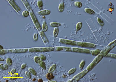 Variety of Life: Xanthophyceae