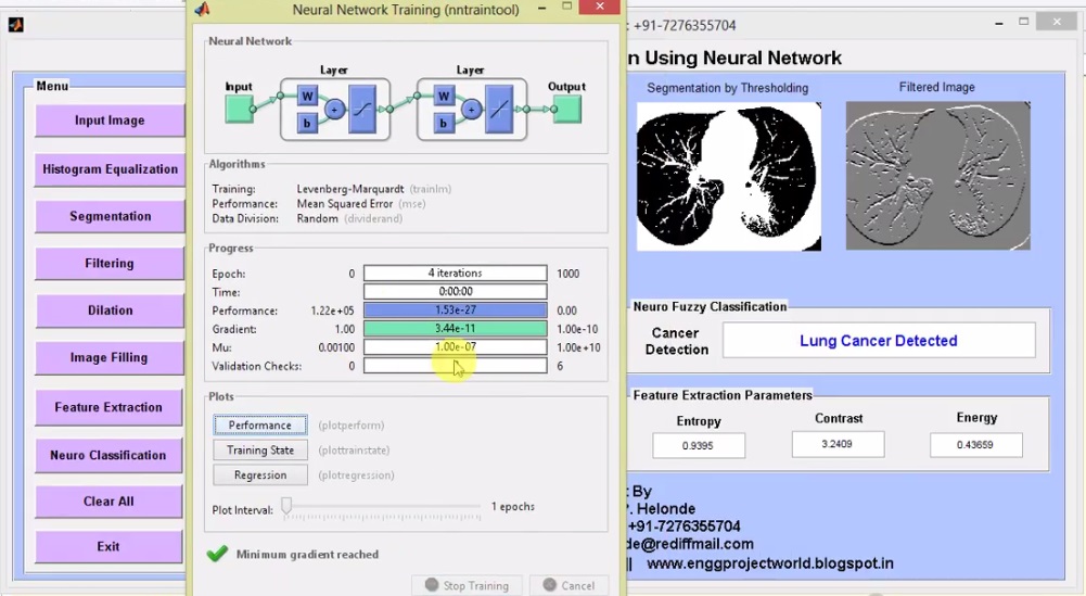 Lung Cancer Detection Using Neural Network Matlab Project With Source Code Ieee Based Project