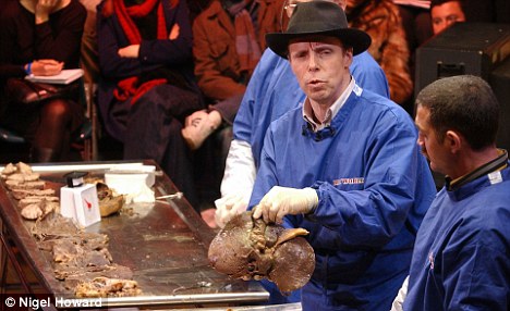 Preludes' Blog of Words: Review: Gunther Von Hagens 'Autopsy' series (DVD)