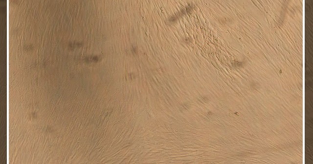 努力不一定會成功, 但成功一定需要努力!: CPE照片分享 - Cytomegalovirus (CMV, 巨細胞病毒)