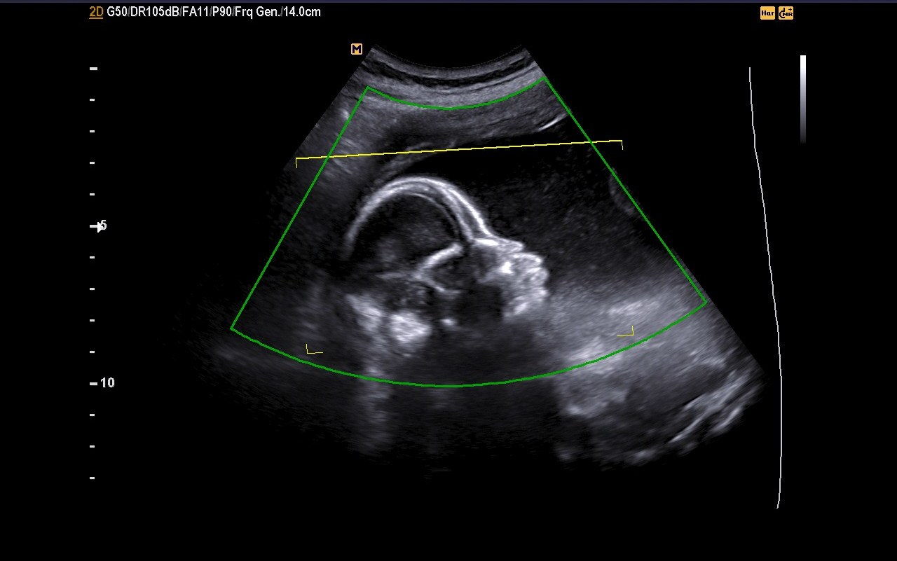 Teknik USG 4 Dimensi