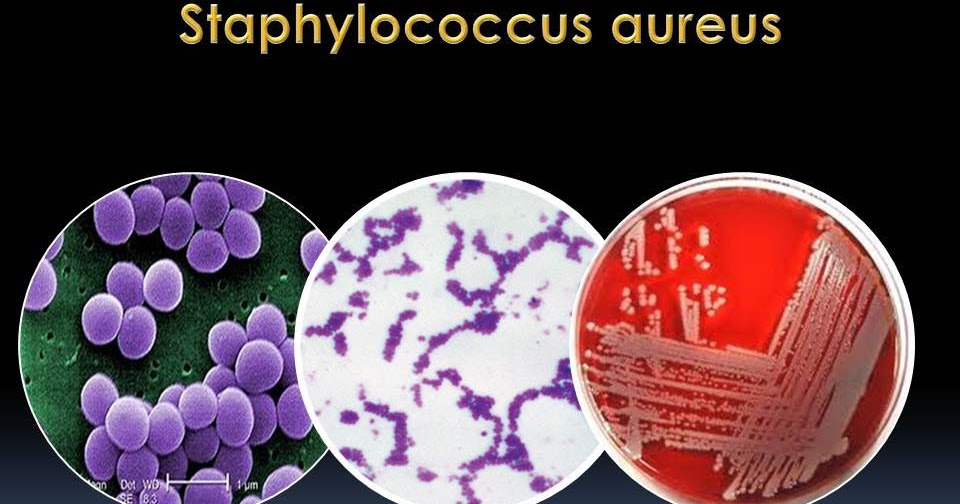 EL MUNDO DE LA MICROBIOLOGÍA : Staphylococcus aureus