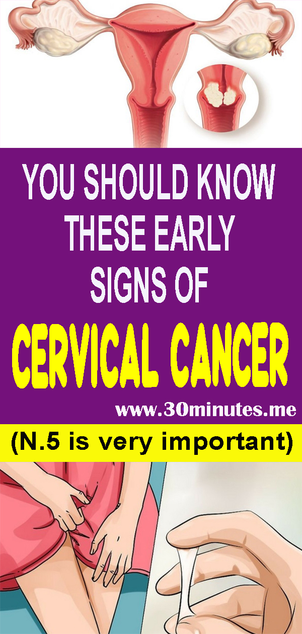 7 Warning Symptoms Of Cervical Cancer That Every Women Should Know Health And Wellness