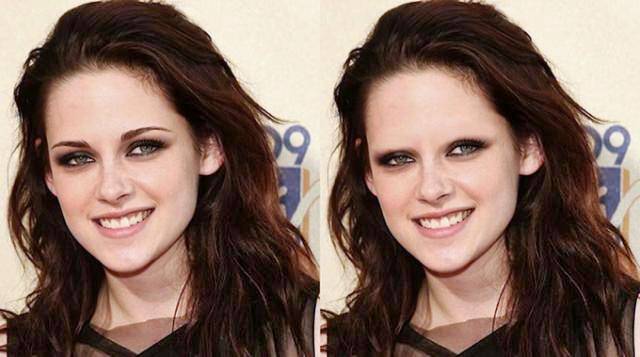 Nexus images News Stories in images: People without Eyebrows