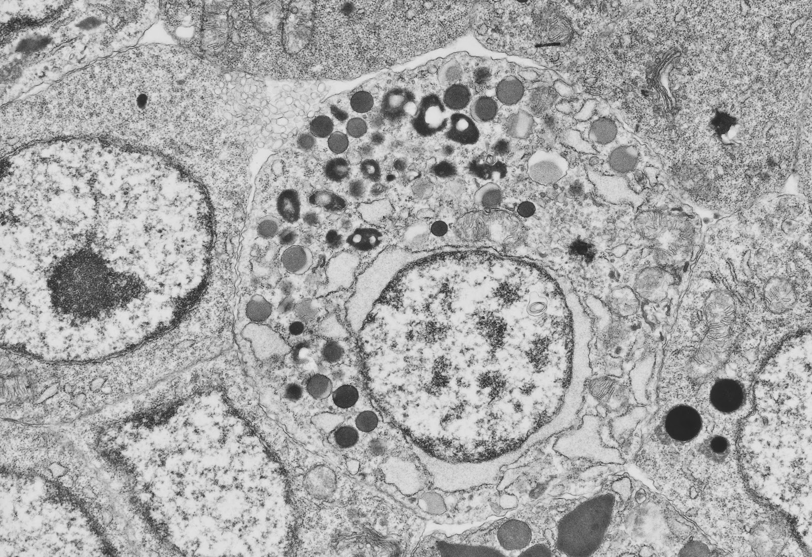 Harbor Watch: The Invasive Club Tunicate