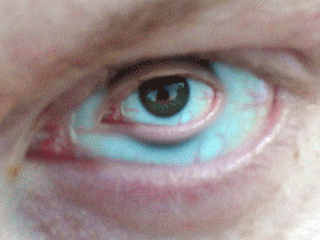 Dimanology: Stop Motion Animation - Eye