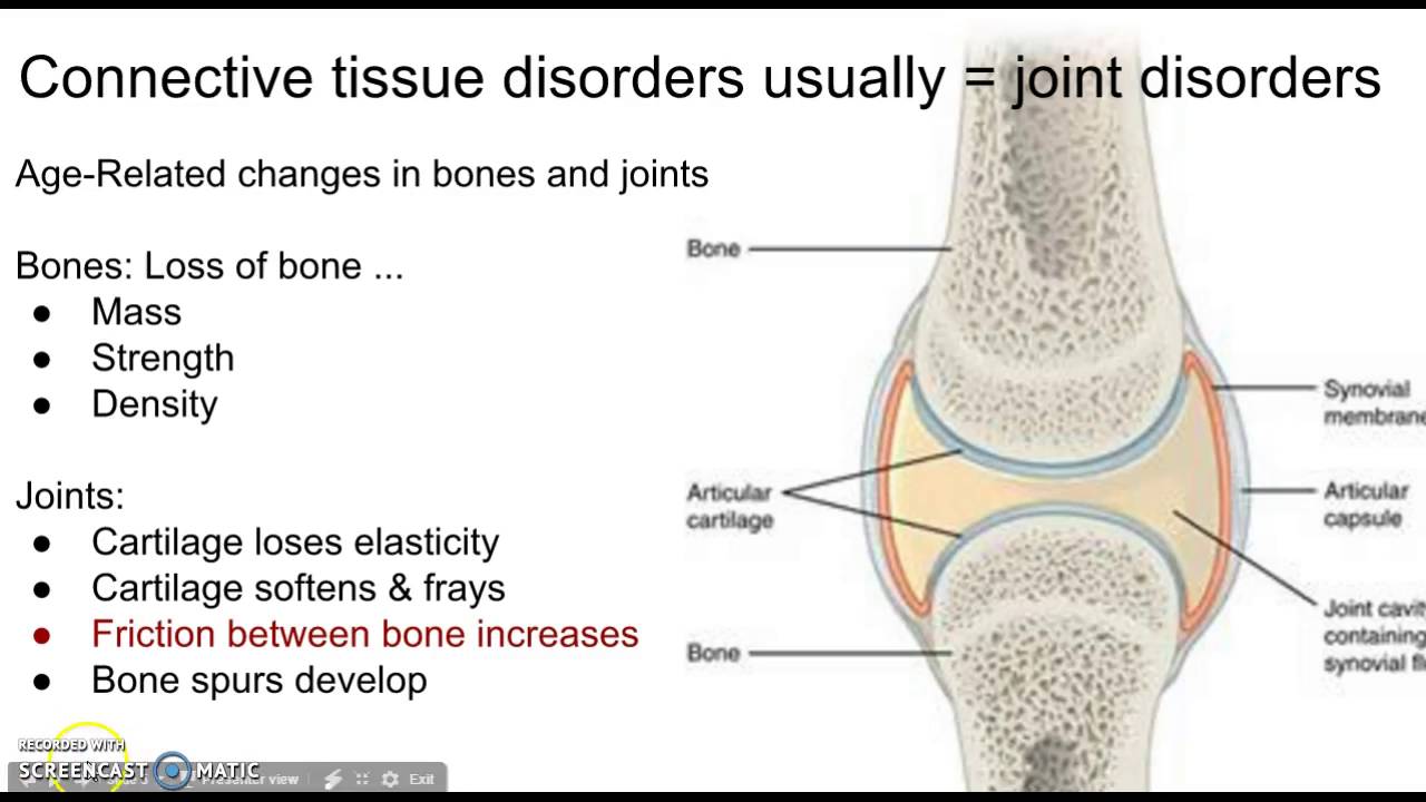 ASK About Vitamins Connective Tissue Disorders Try Serracor Healthy ASK About Vitamins Connective Tissue Disorders Try Serracor Healthy
