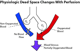 E- Learning: VQ mismatch - Acute Zorg Blog