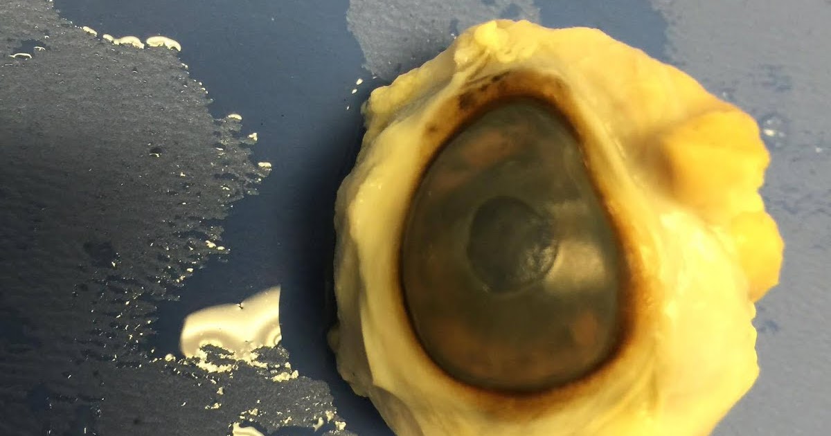 Anatomy and Physiology : Sheep Eye Dissection Lab