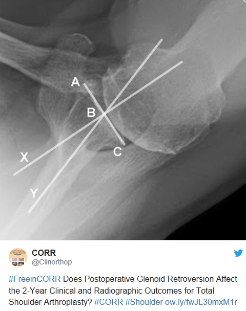 Revisiones_bibliográficas: 2018