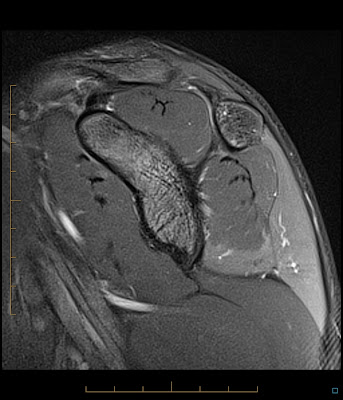 Radiology Cases: 2011