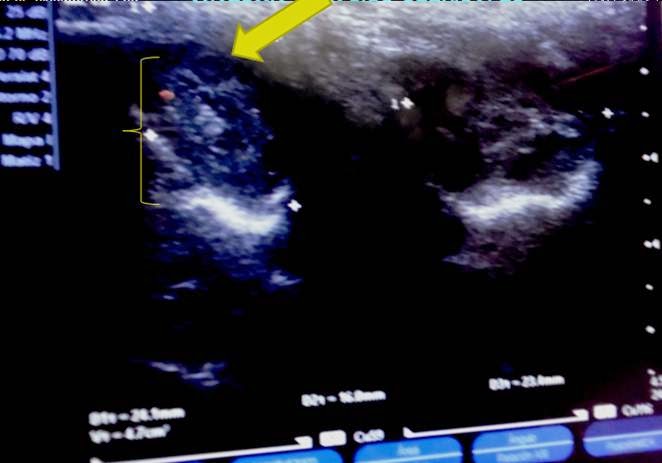 RADIOLOGÍA Mayhuasca PERÚ: diciembre 2014