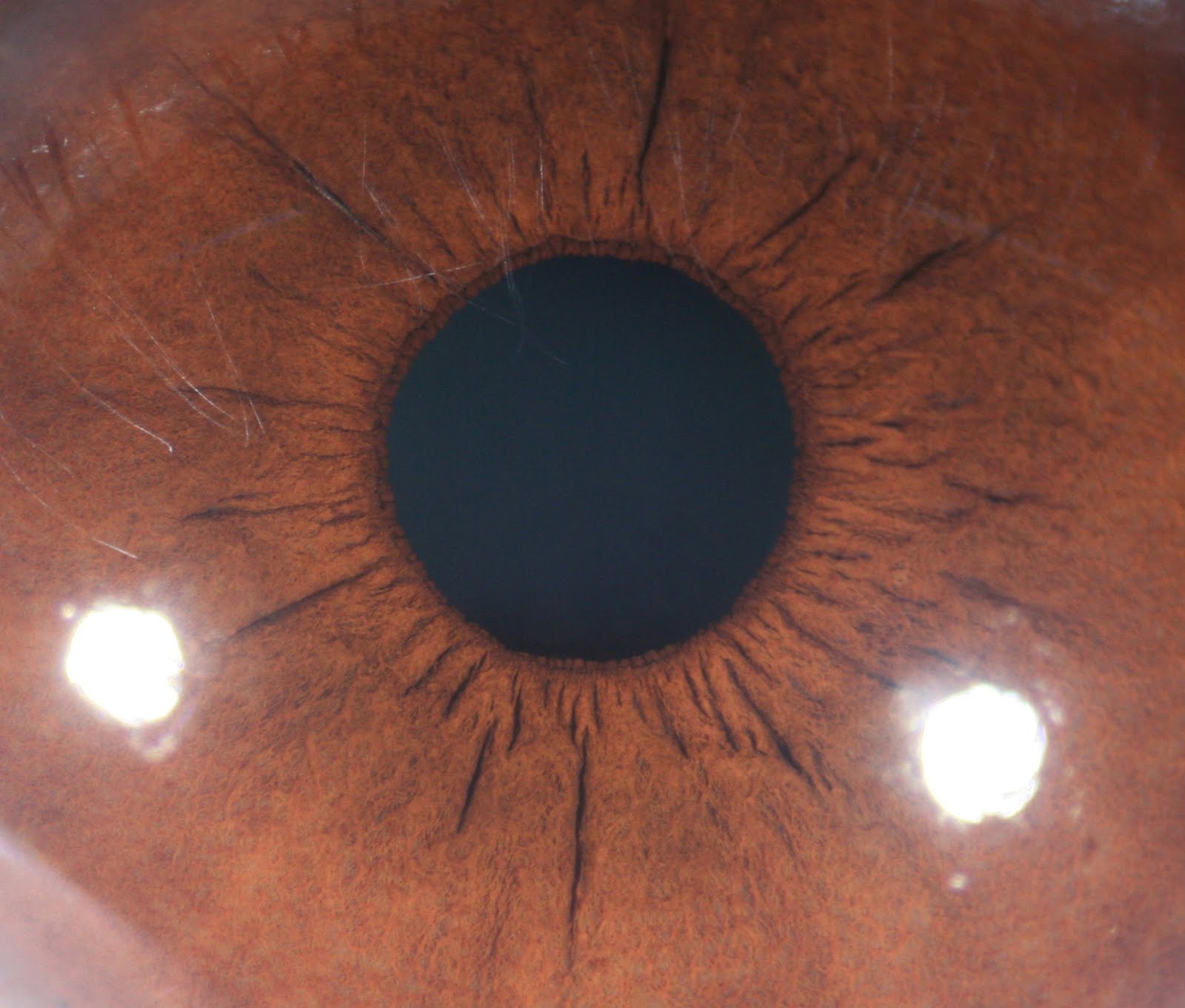 Modern & Multidimensional Iridology: Pupil Flatness, Mammilations ...