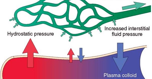 Edema - Definition, pathophysiology, causes, clinical features ...