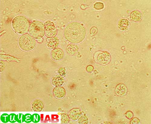 bacteria urinalysis microscopy