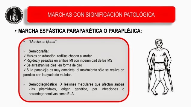 Tipos de Marchas Patológicas - Enfermagem em Ortopedia