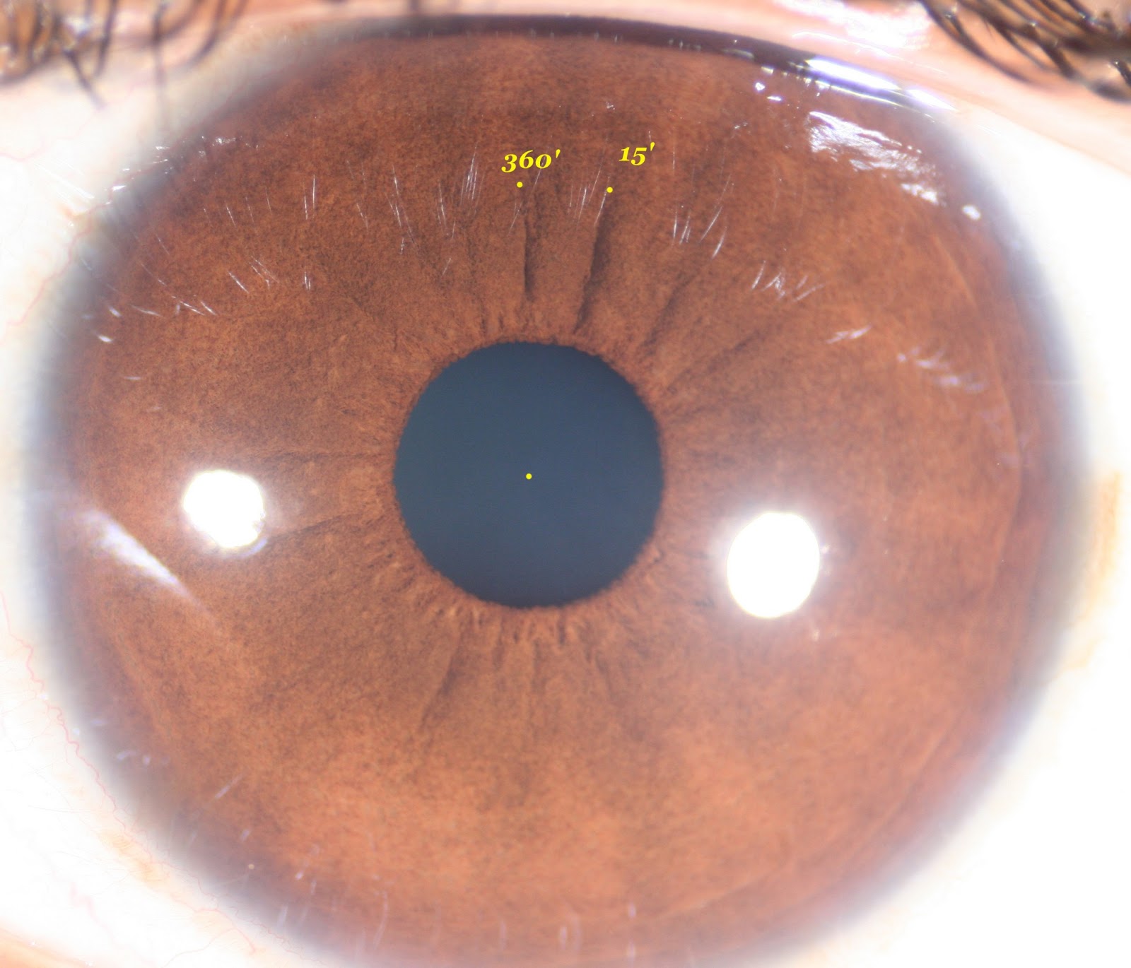 Modern & Multidimensional Iridology: Classical, Embryological ...