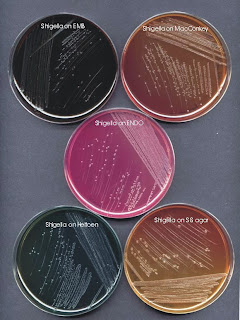 Infection Detection: Shigellosis